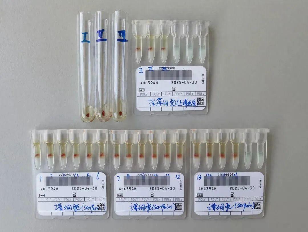 ရှားပါးသည်၊ တရုတ် မြန်မာ နယ်စပ်ဒေသရှိ ပေါင်စန်းမြို့တွင် ဒိုင်နိုဆောသွေးရှိသူတစ်ဦး တွေ့ရှိခဲ့